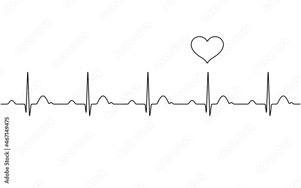 ECG. The heart beat like a black line on a white background. Pulse ...