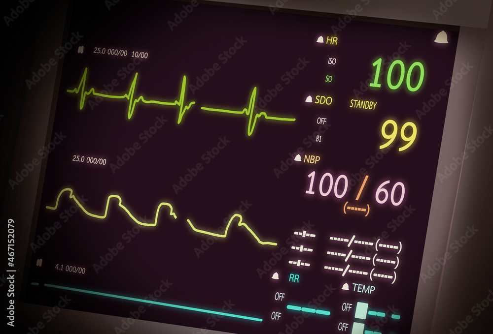 Patient monitor showing vital signs ECG and EKG. Vector illustration ...