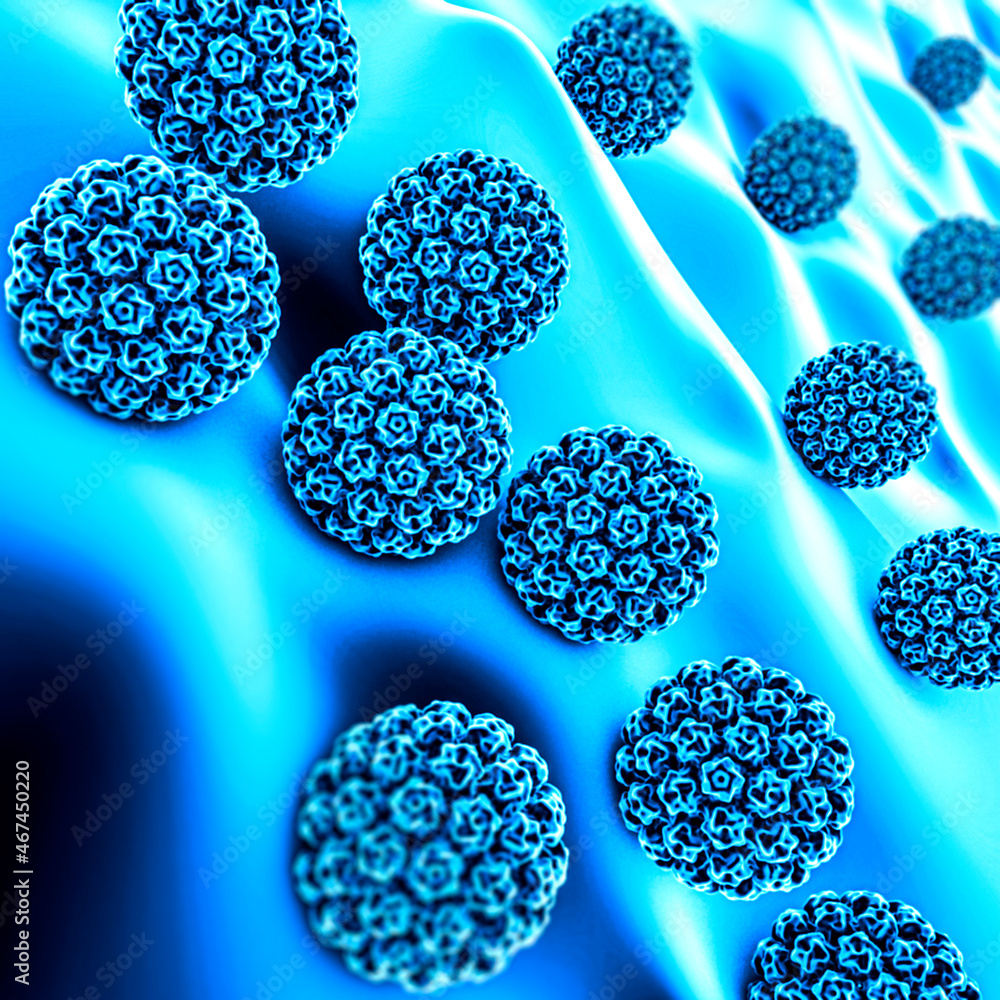 Human papillomavirus infection. Virus. HPV is the most common sexually ...