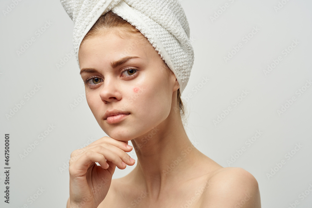 pretty woman with a pimple on the face skin problems close-up Stock ...