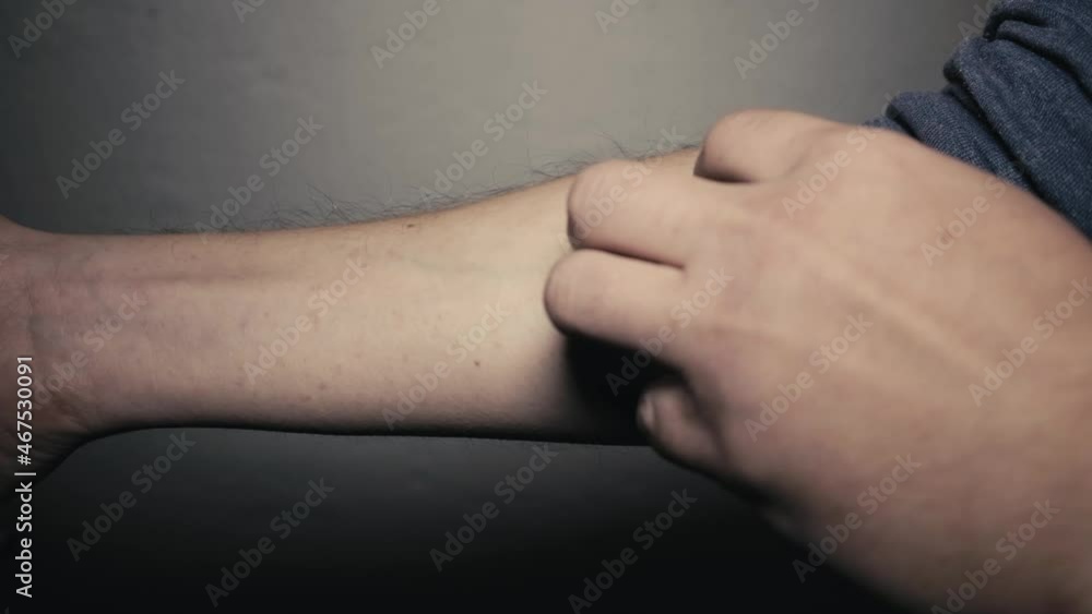 Man suffering from itching hand skin and scratching an itchy place ...