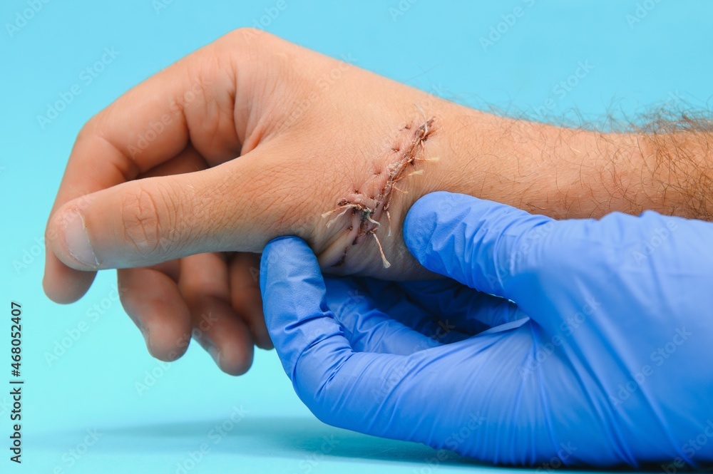 examination by a doctor of a cut on the arm Stock Photo | Adobe Stock
