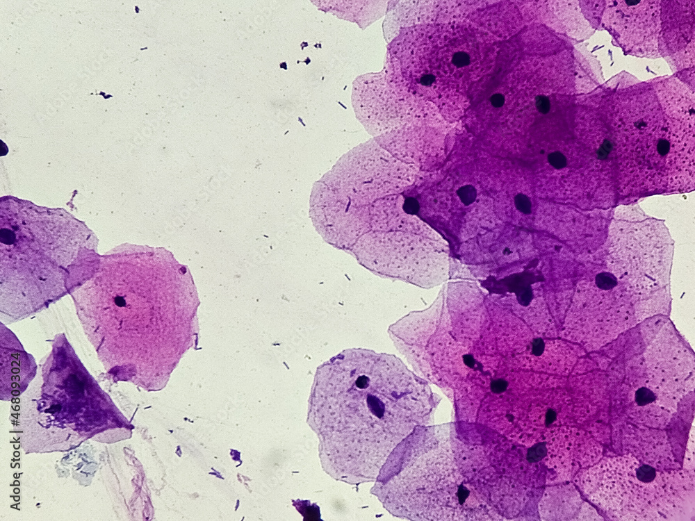 Squamous epithelial cells under microscope view for medical education ...