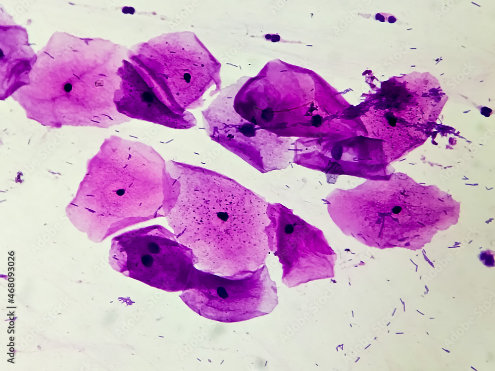 Squamous epithelial cells under microscope view for medical education ...