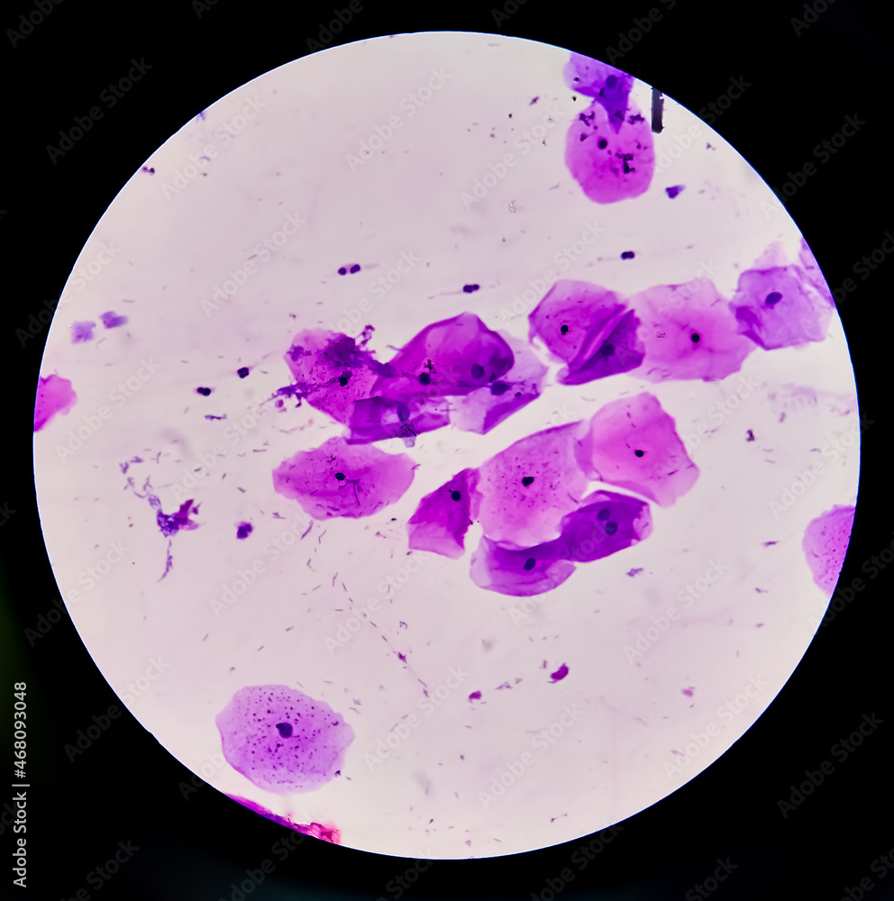 Squamous epithelial cells under microscope view for medical education ...