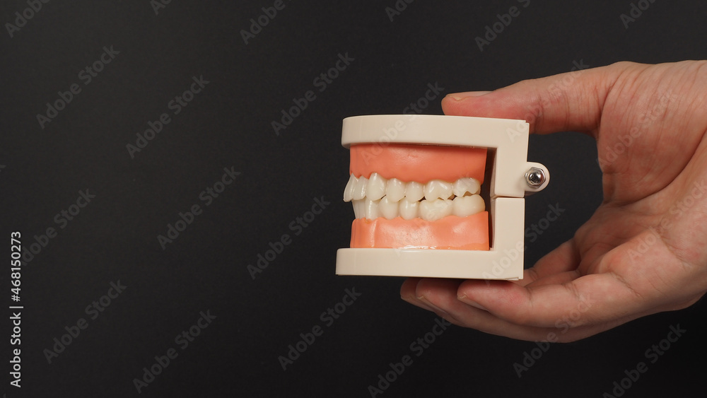 Orthodontic model of teeth in hand on Black background. Stock Photo ...