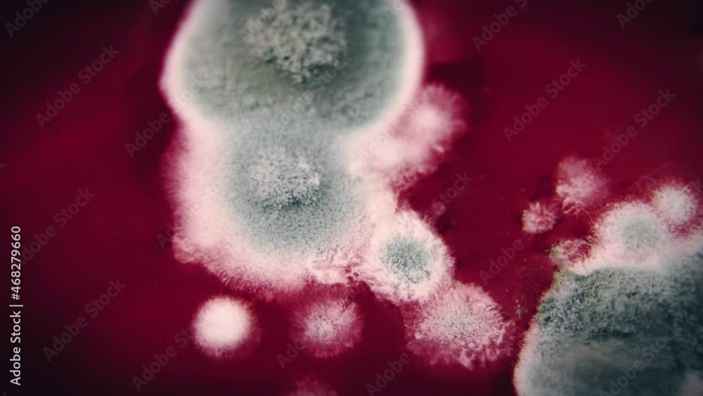 Fungal spores in the liquid. Viral bacterium in the blood.Fungal ...