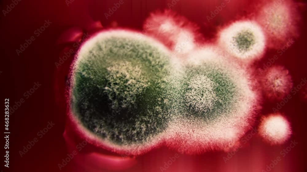 Video Stock Fungal spores in the liquid. Viral bacterium in the blood ...