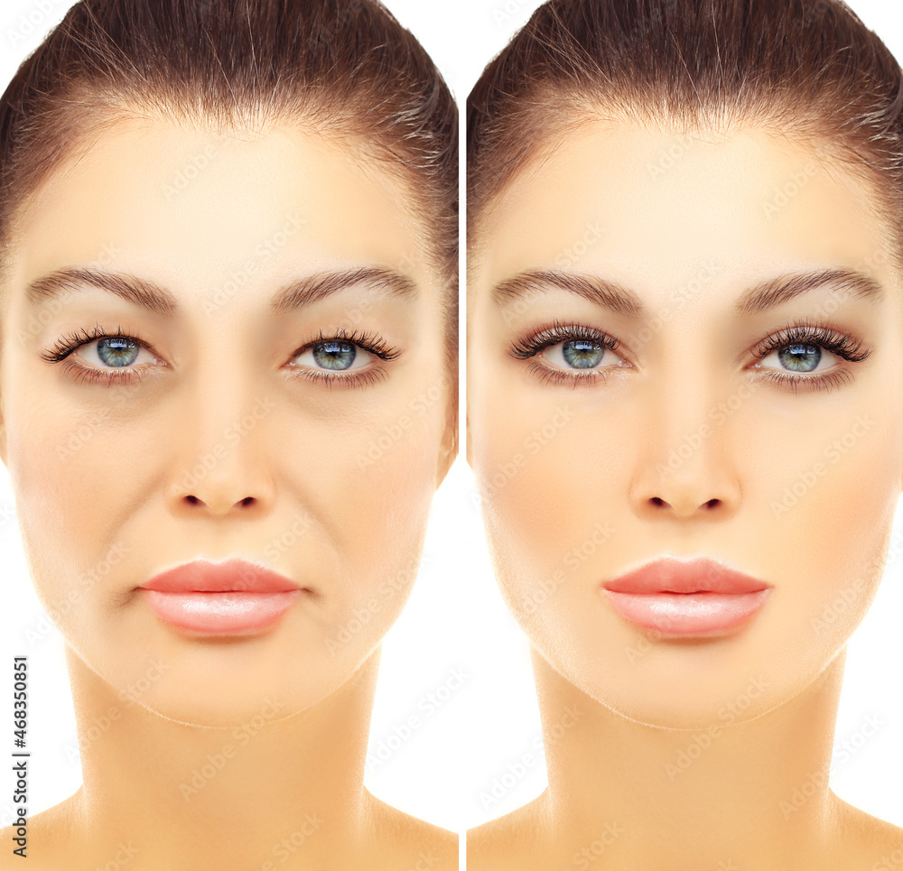 Aging. Mature woman-young woman.Face with skin problem. Stock Photo ...