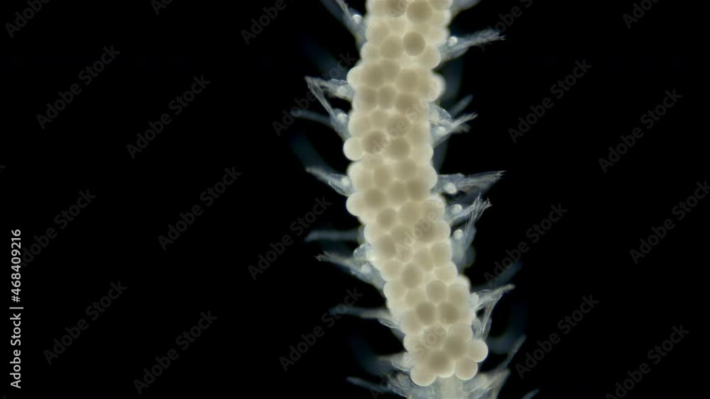 worm Polychaeta under a microscope, Syllidae family, female with eggs ...