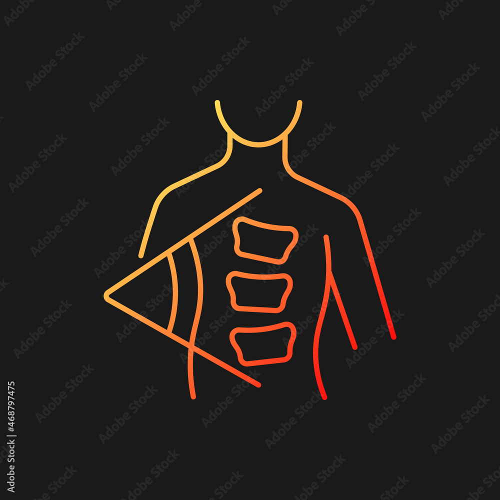 Cobb method gradient vector icon for dark theme. Cobb angle. Scoliosis ...