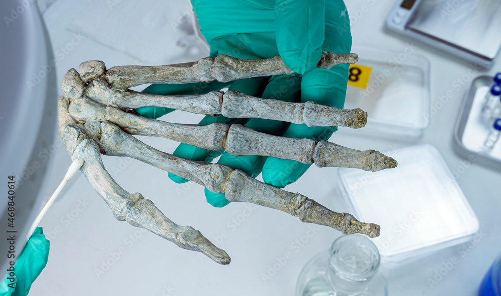 Police scientist takes samples from right hand of skeleton murder ...