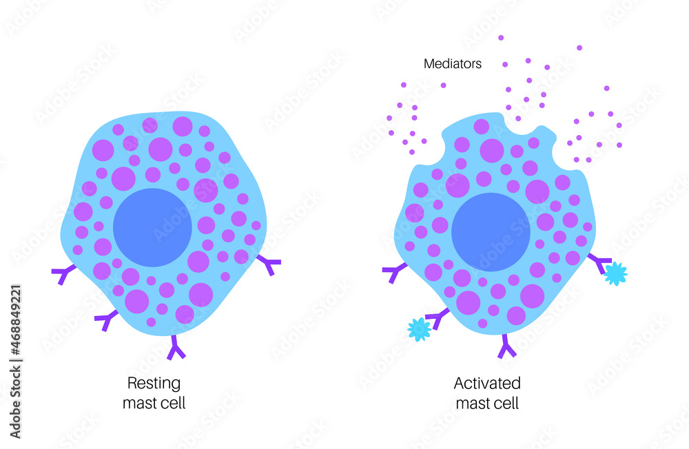 Mast cell poster Stock Vector | Adobe Stock