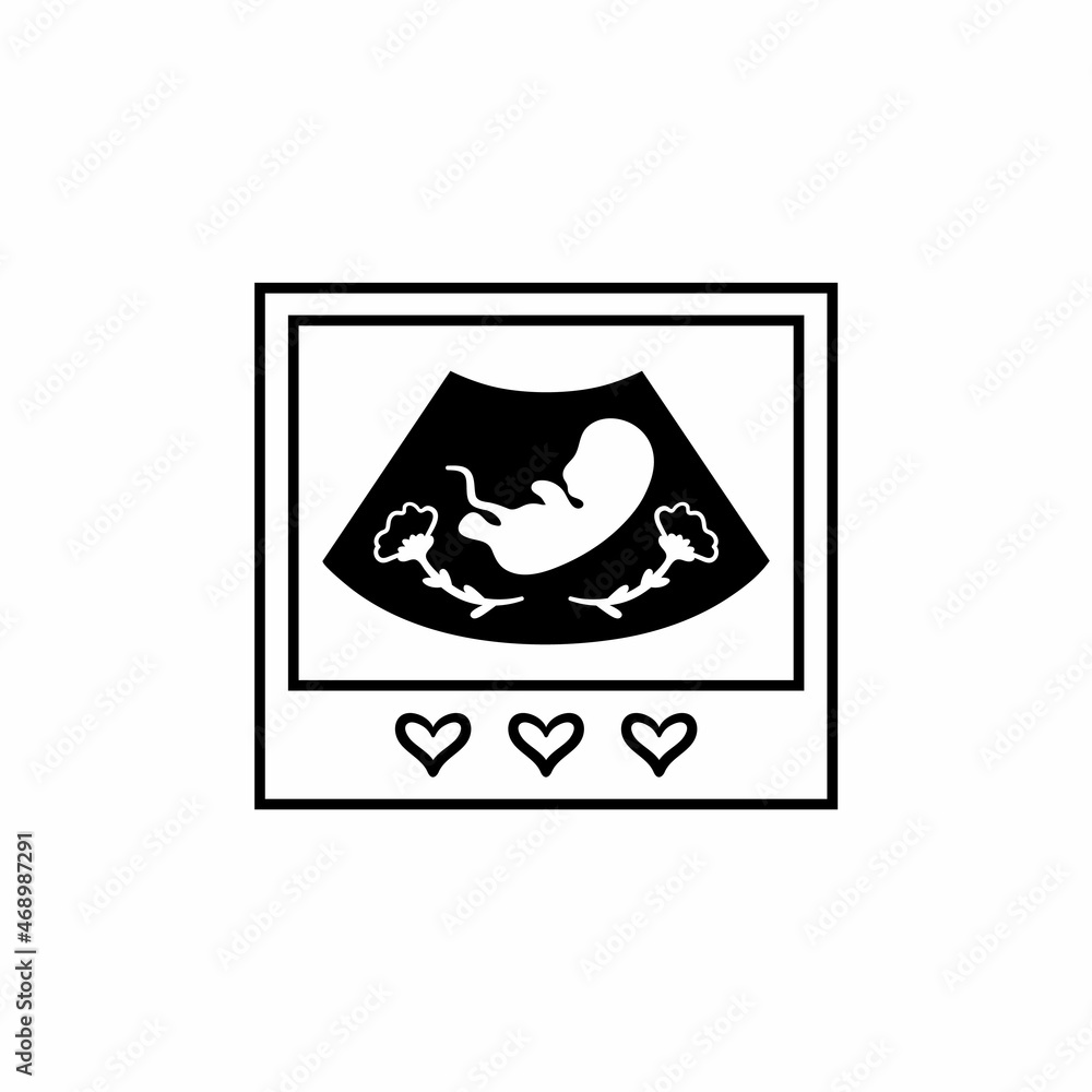 Ultrasound of baby in mother's womb. Pregnancy ultrasound concept ...