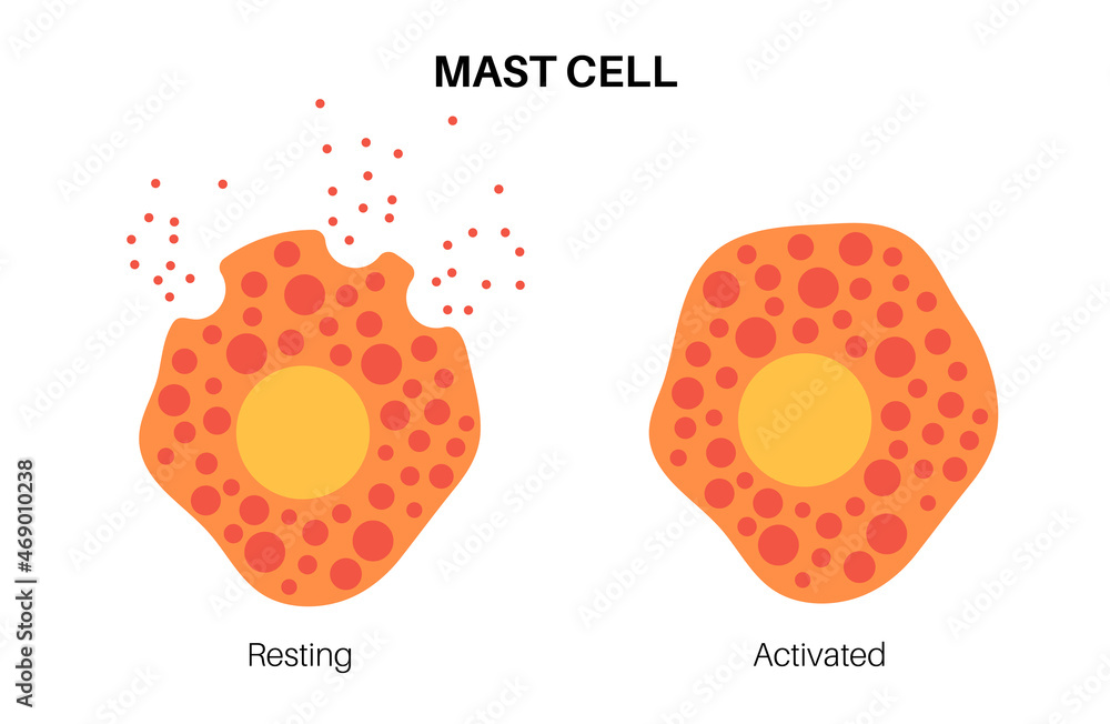 Mast cell poster Stock Vector | Adobe Stock