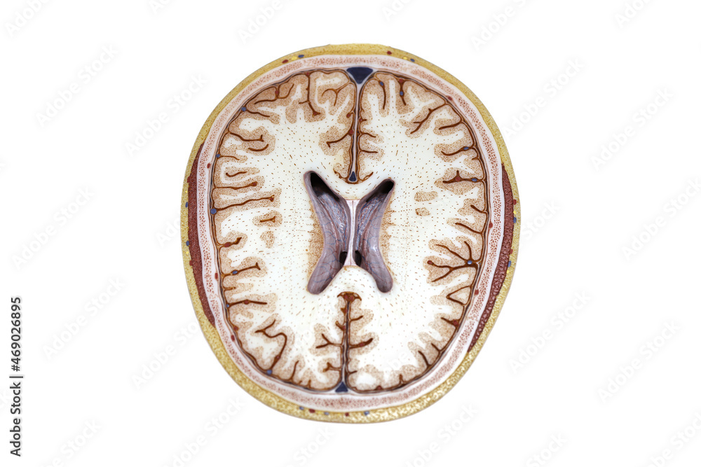 The horizontal section through the human head model plate 3 from 11 ...