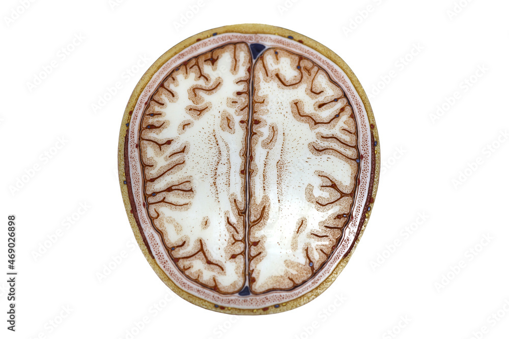 The horizontal section through the human head model plate 2 from 11 ...