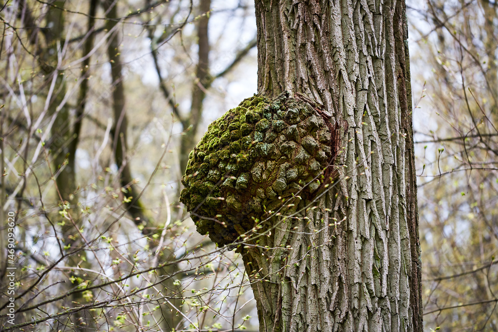 A giant tree burl caused by parasitoid bacteria. A birch tree with ...