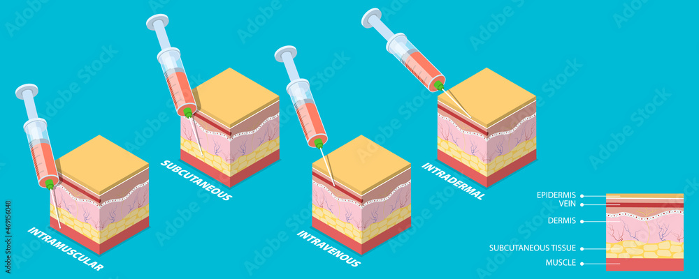 3D Isometric Flat Vector Conceptual Illustration of Injection Types ...