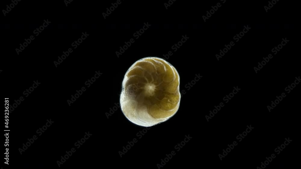 Foraminifera under a microscope, class Rotaliata, possibly order ...