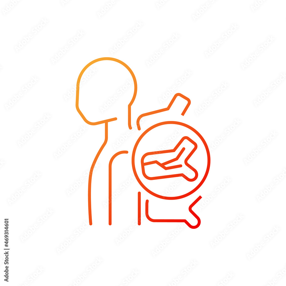 Spinal fracture gradient linear vector icon. Spinal bones injury ...