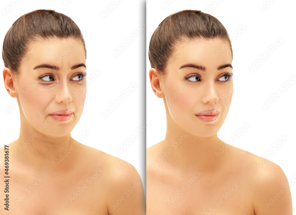 Effects of ageing,Frown/scowl lines ,Nasolabial folds,Neck ,Under eye ...