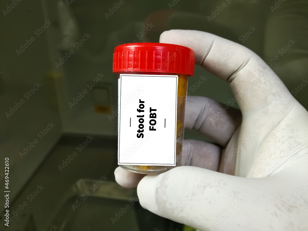 Fecal occult blood test (FOBT). Doctor holding sample container with ...