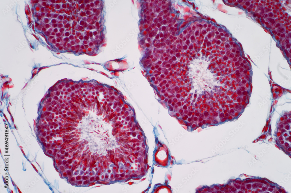 Human testis under the light microscope view. Shows spermatogonia ...