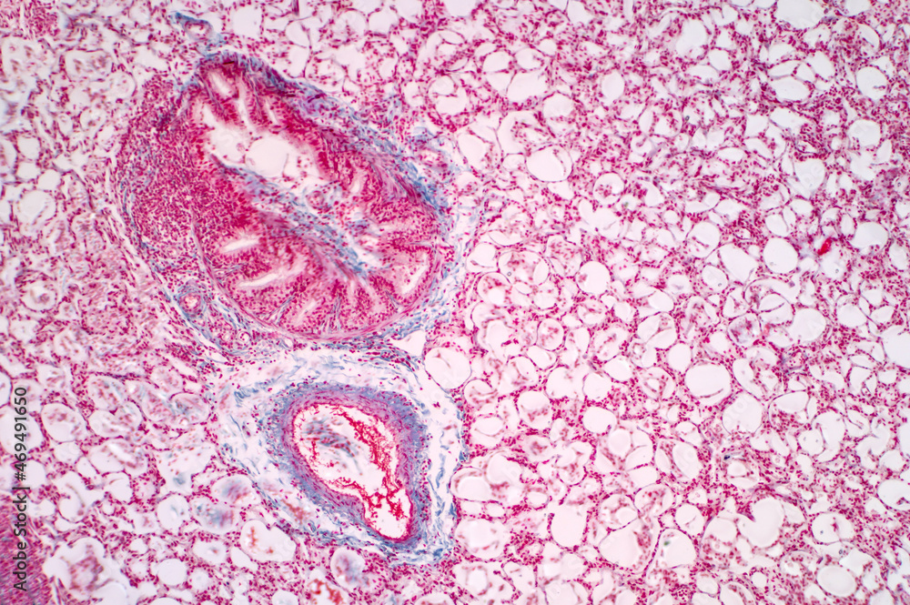 Human lung histilogy under light microscope, The lungs is organs of the ...