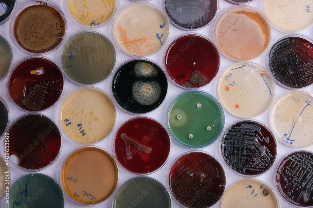 collection of culture plates contain growth of microorganisms on ...