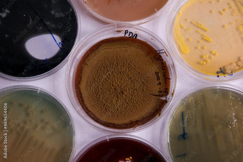 collection of culture plates contain growth of microorganisms on ...