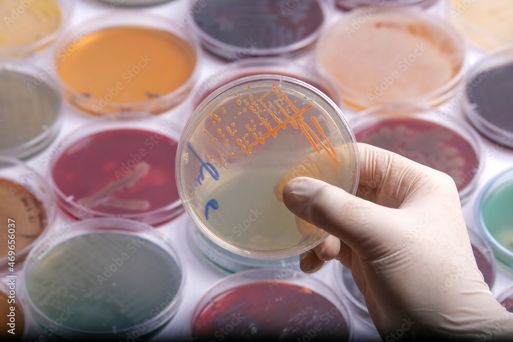 collection of culture plates contain growth of microorganisms on ...