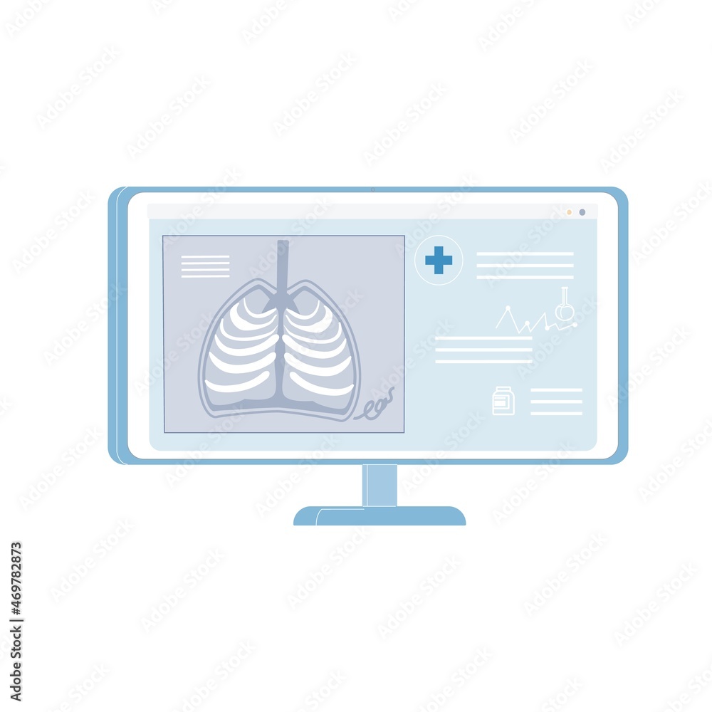Cartoon flat x-ray photo of human chest on monitor screen isolated on ...