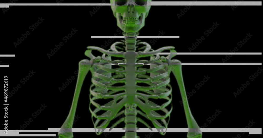 color CRT overlay of old smash screen with sum and texture of human ...