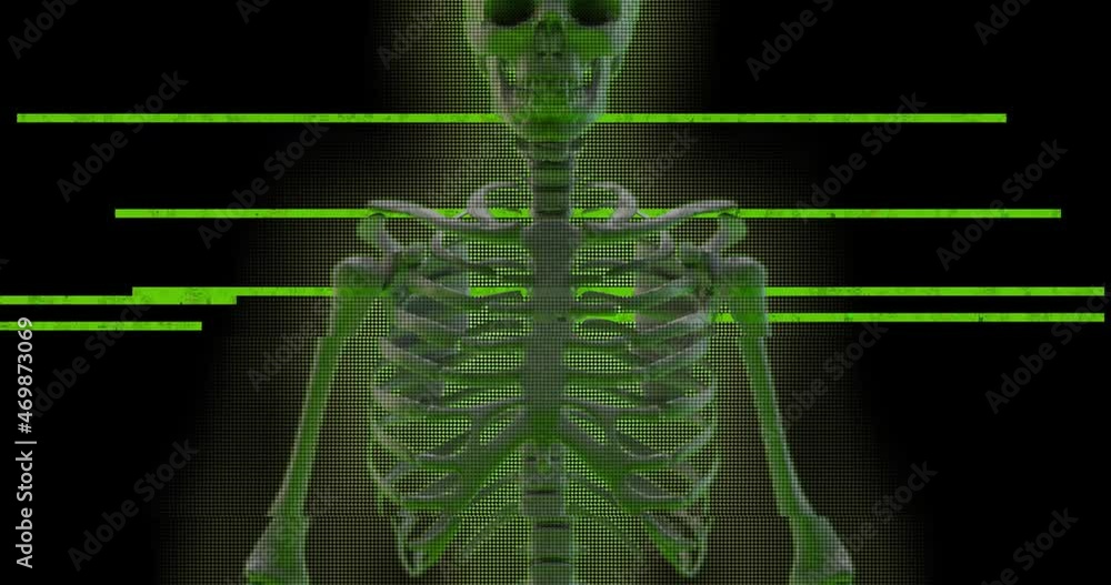 color CRT overlay of old smash screen with sum and texture of human ...