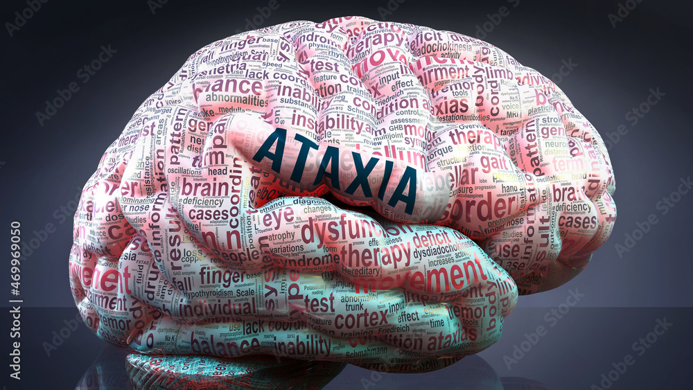 Ataxia in human brain, hundreds of crucial terms related to Ataxia ...