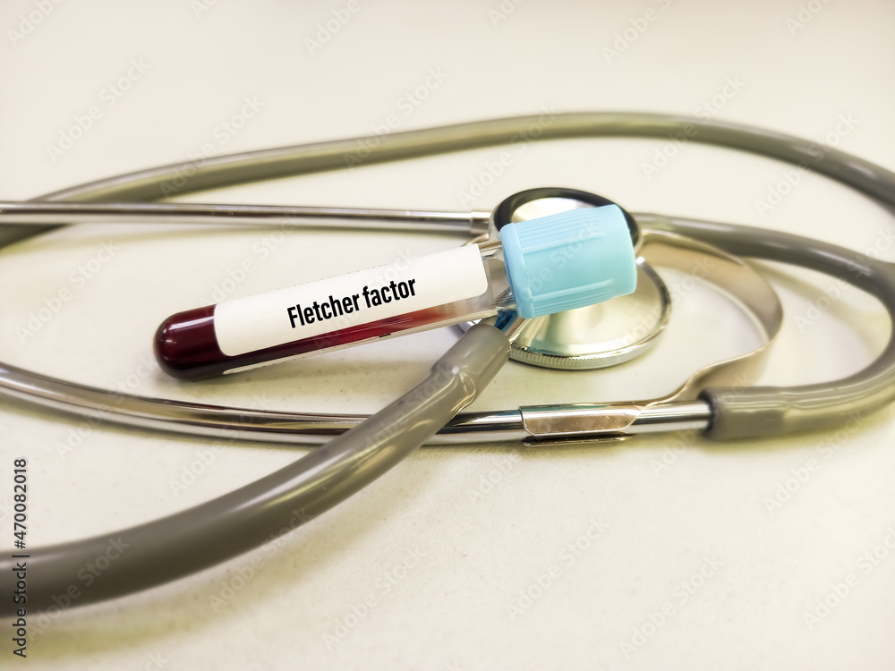 Blood sample for Fletcher factor test, also known as Prekallikrein ...