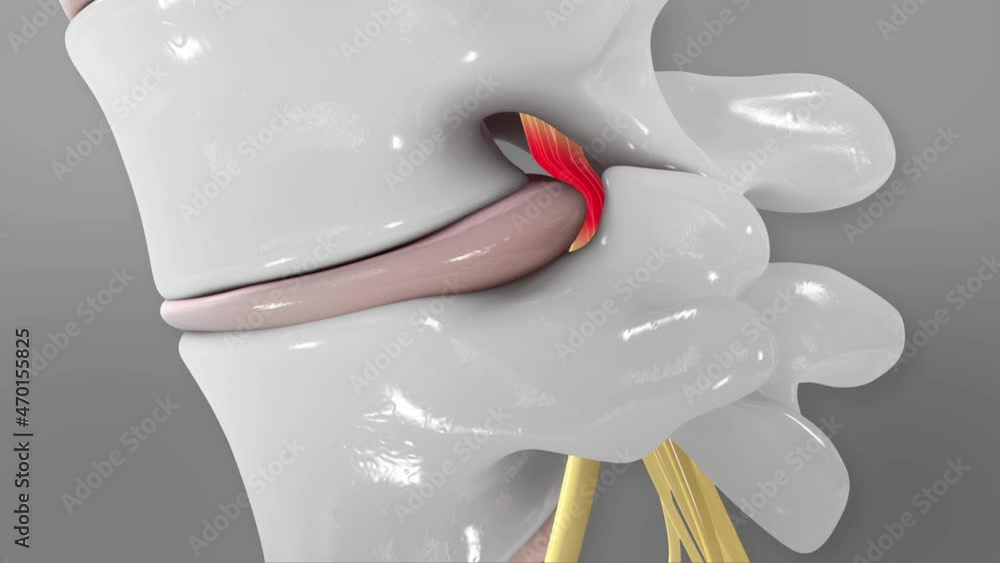 Herniated Disc Flexion 3D Animation 素材庫影片 | Adobe Stock