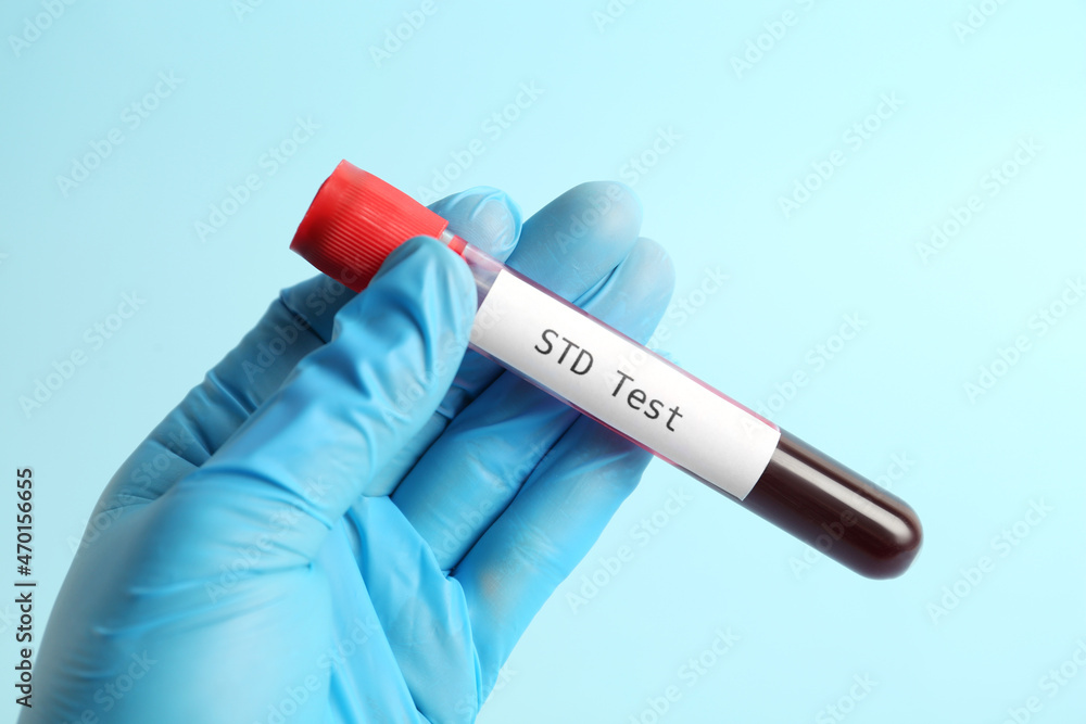Scientist holding tube with blood sample and label STD Test on light ...