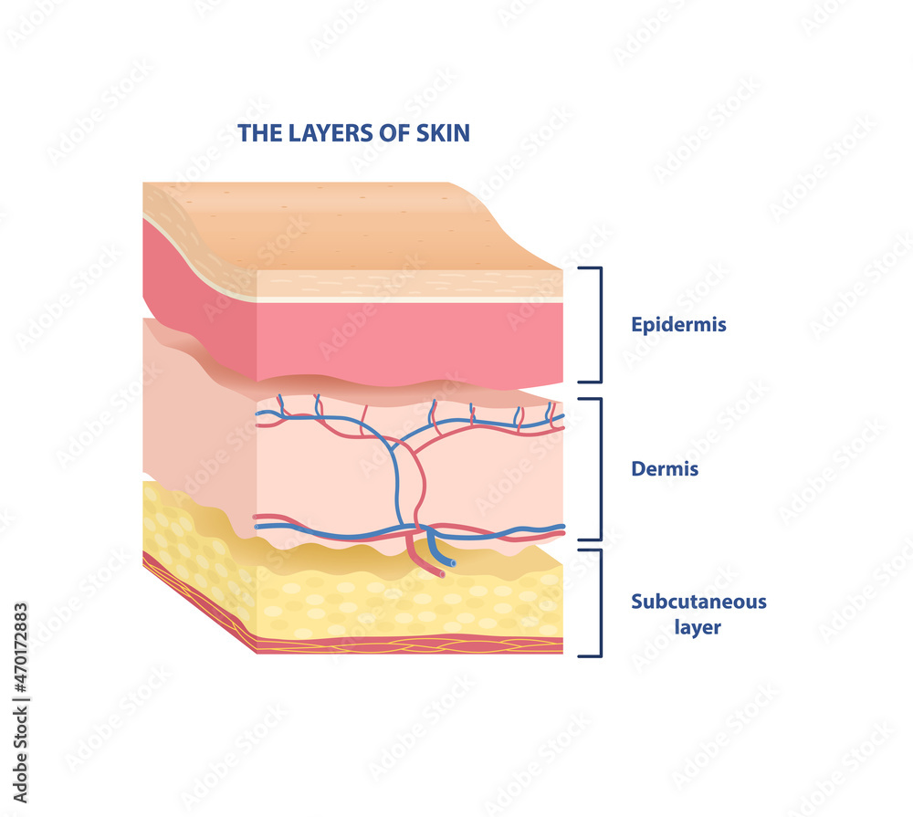 Layers of skin sticker. Epidermis, dermis and subcutaneous tissue ...