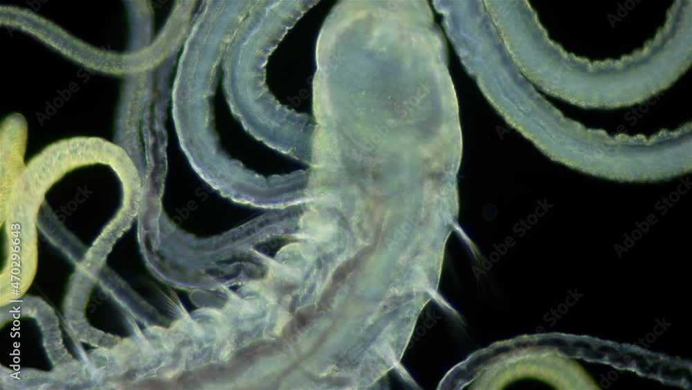 Worm Polychaeta under a microscope. Family Cirratulidae. They have many ...