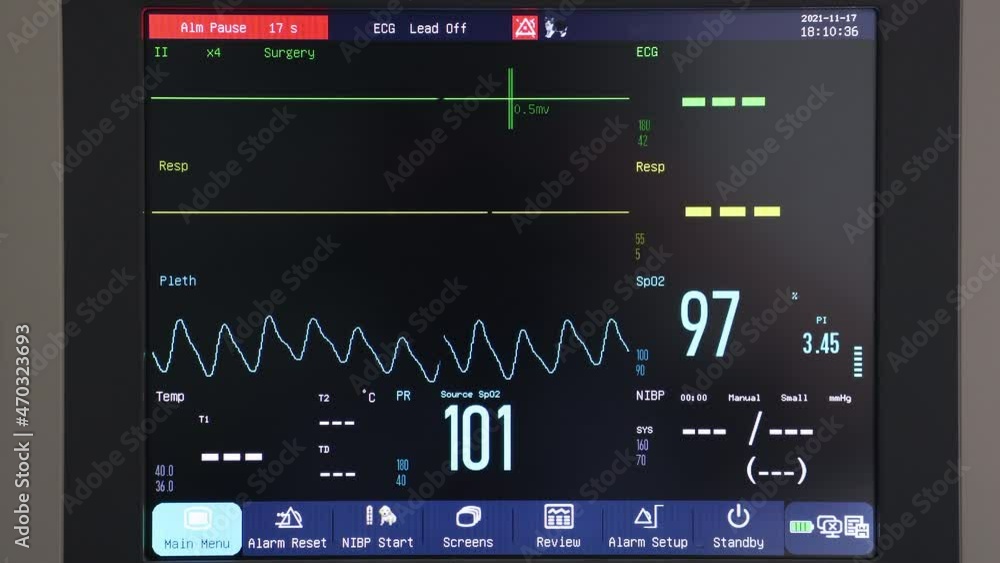 Monitors in hospital theater Medical vital signs monitors in a hospital ...