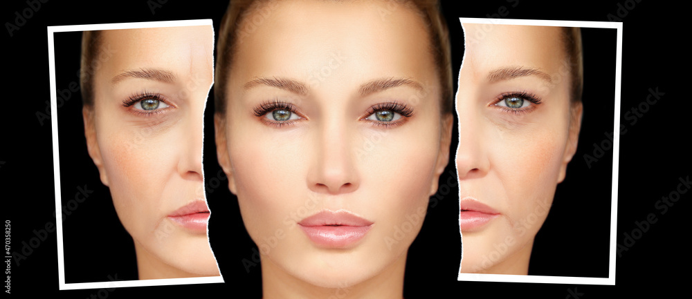 Aging. Mature woman-young woman.Face with skin problem.Showing photos ...