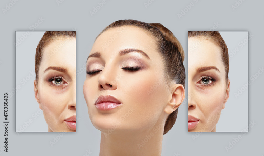 Effects of ageing,Frown/scowl lines ,Nasolabial folds,Neck ,Under eye ...