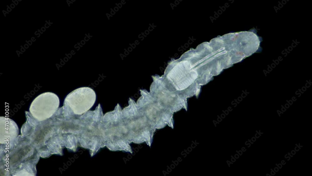 Worm family Syllidae under a microscope, Polychaeta class, Exogoninae ...