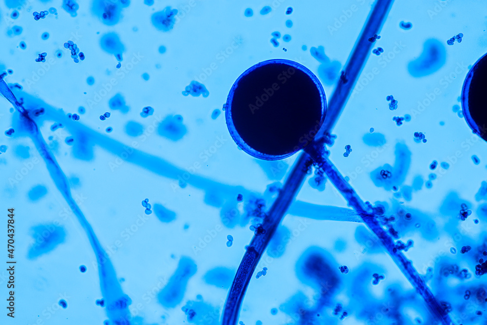 Characteristics of Rhizopus is a genus of common saprophytic fungi on ...