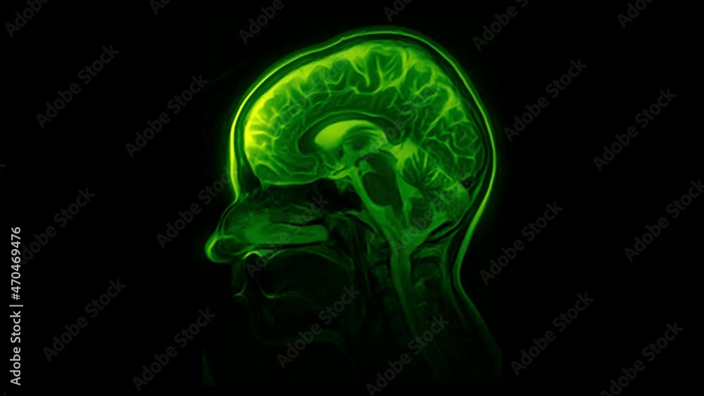 Computed medical tomography MRI upscaled scan of healthy young female ...