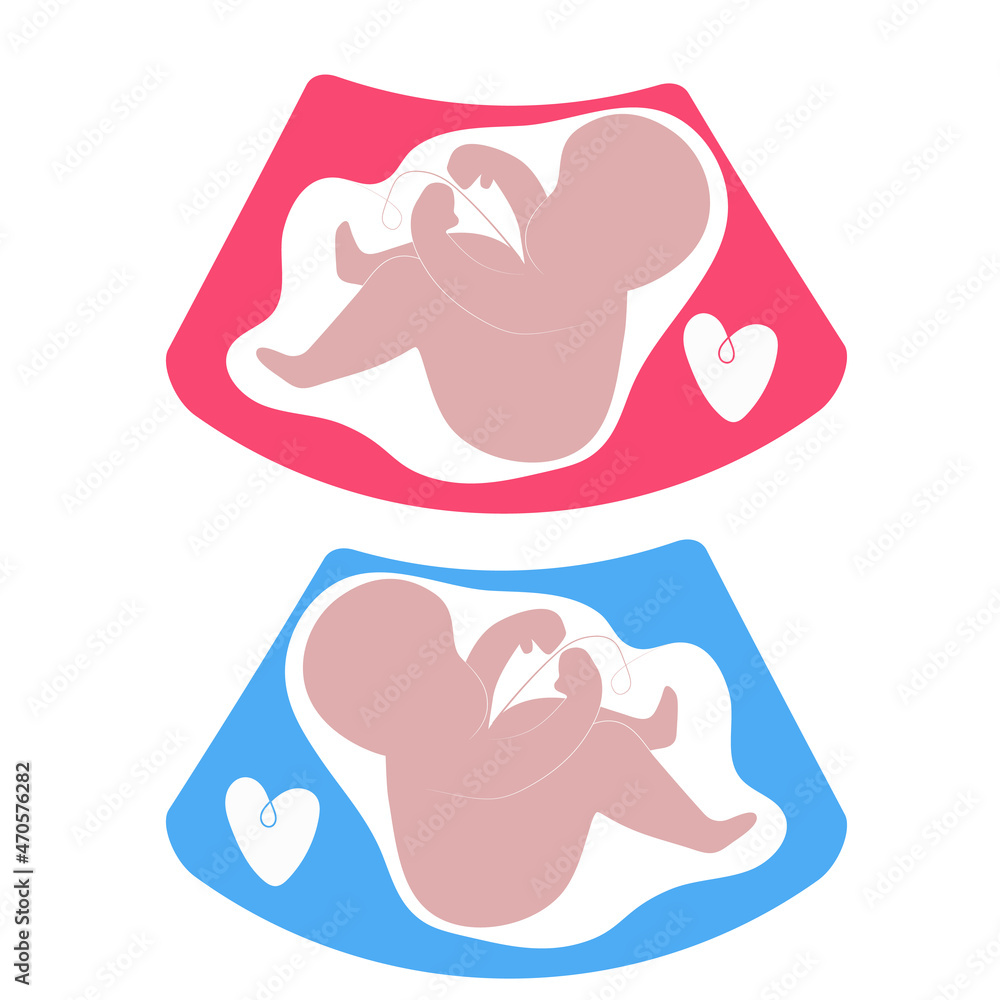 Simple illustration of ultrasound unborn baby girl and boy on white ...