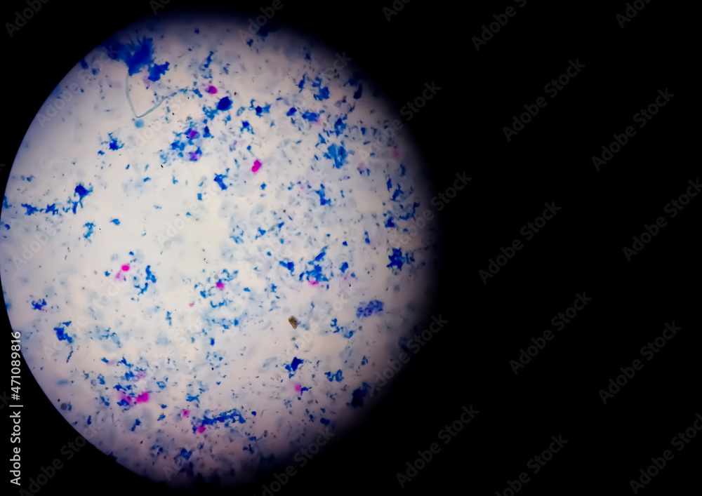 Sputum Smear