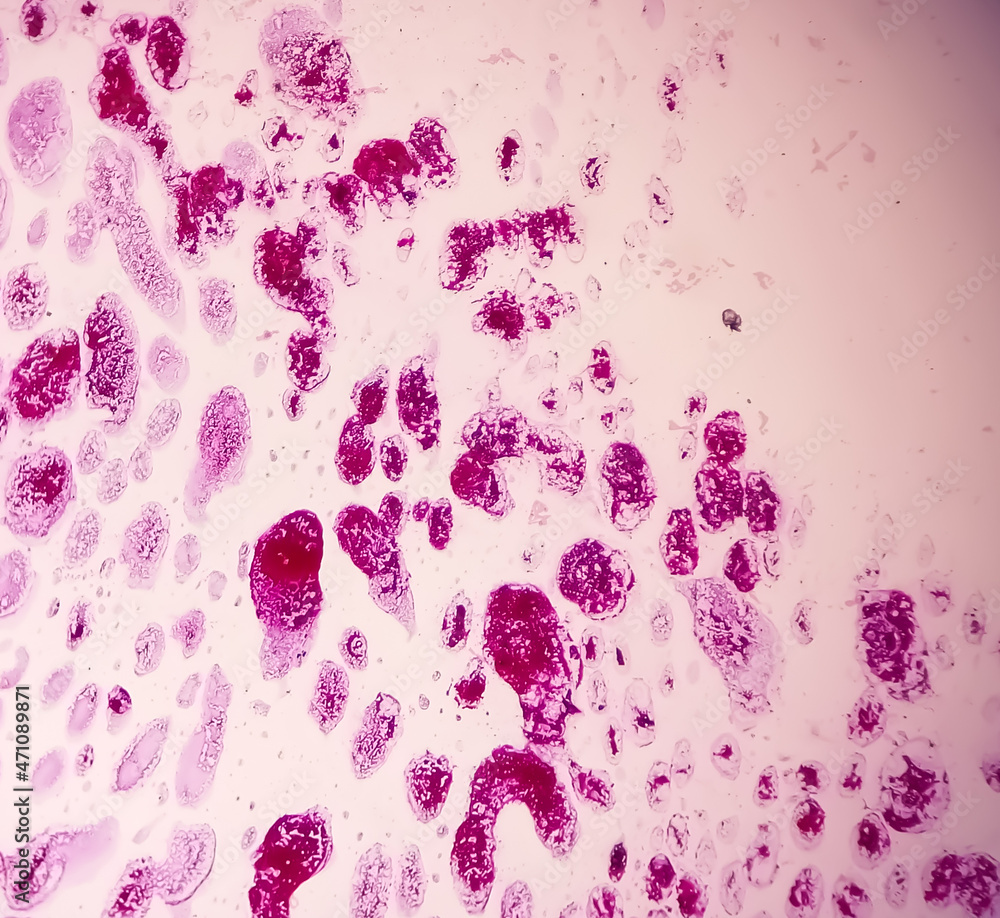 Gram staining, also known as Gram's method, is a method of ...